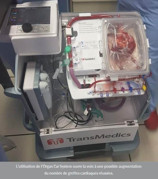 Une 1ère nationale en transplantation cardiaque - CHU de Lille